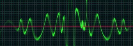 The Definitive Zigbee Guide - Smart Home Perfected